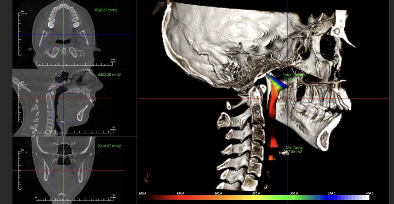 Advanced Occlusion Study Club: Global Diagnosis Mastery Course - Global ...